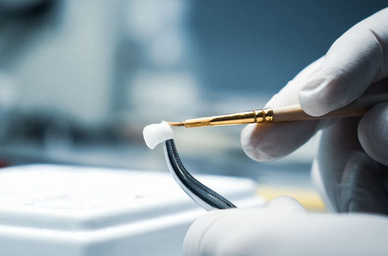 Step-by-Step Dental Crown Procedure: A Detailed Guide | Youth Dental