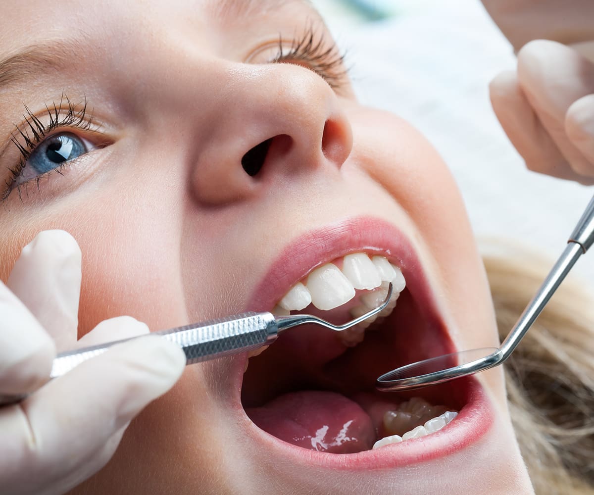 Tooth extraction for kids | tooth extraction Denver