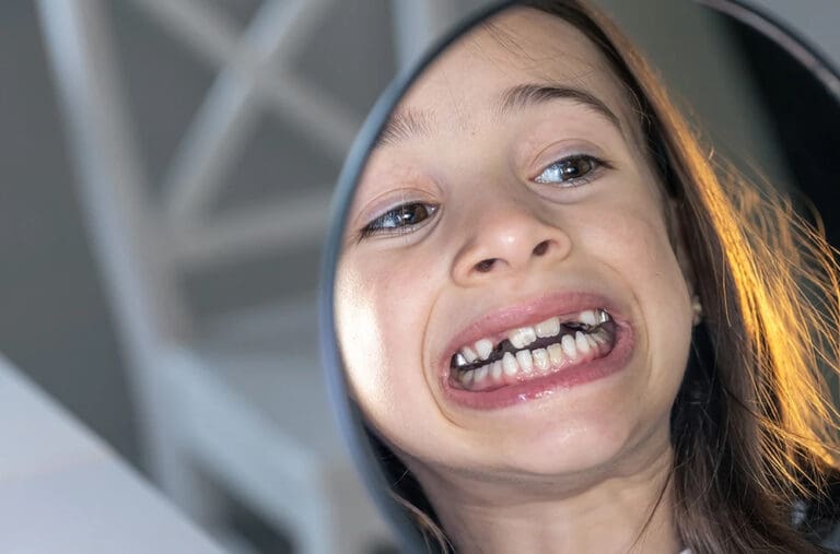 Types of crooked teeth